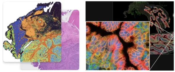 10x Genomics Visium HD vs. Xenium - Omics Empower